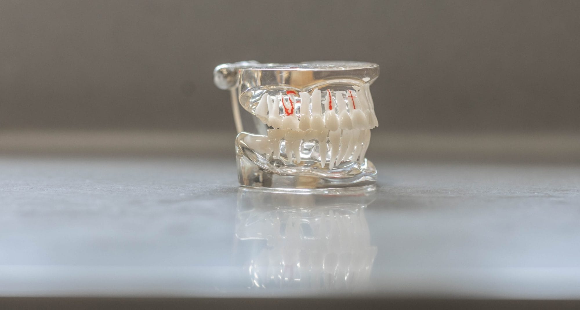 Root Canal Treatment Westerham - Dental Practice in Oxted