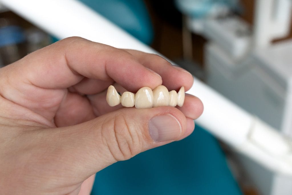 Bridges Westerham - Dental Practice in Oxted